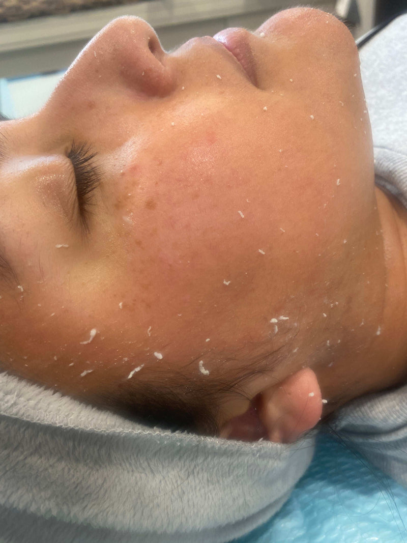 Skin Sheek Xposed Instant Exfoliating Spray