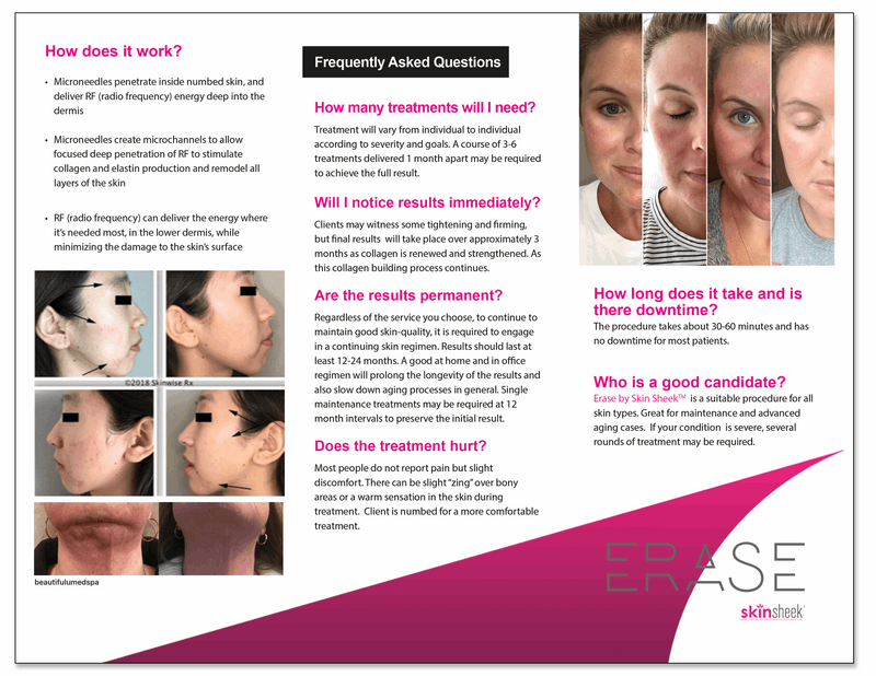 Erase Brochure – Skin Sheek