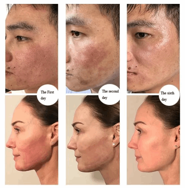 "Refine Rx" by Skin Sheek – Skin Sheek